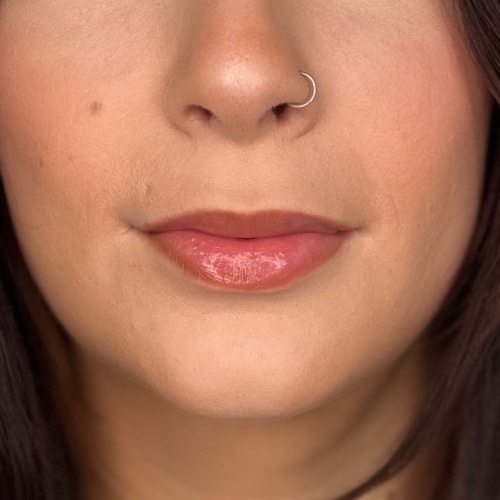 Lip Building - La Clinique Aesthetics