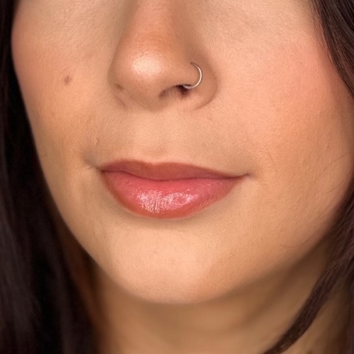 Lip Building - La Clinique Aesthetics