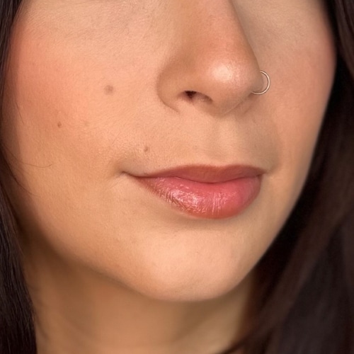 Lip Building - La Clinique Aesthetics